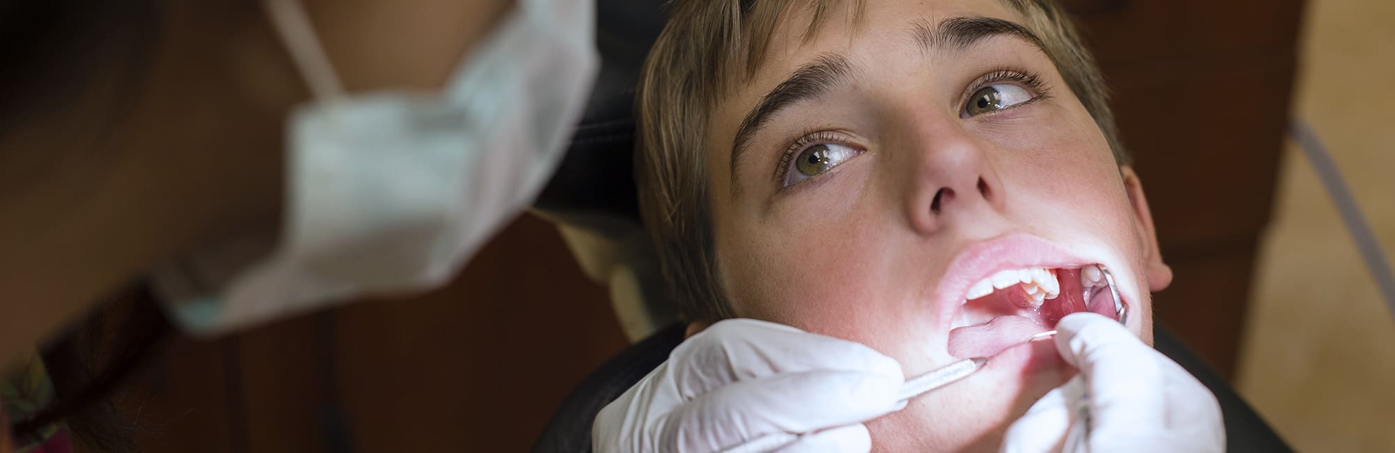 Wisdom Teeth Removal - Corinna Dental Group